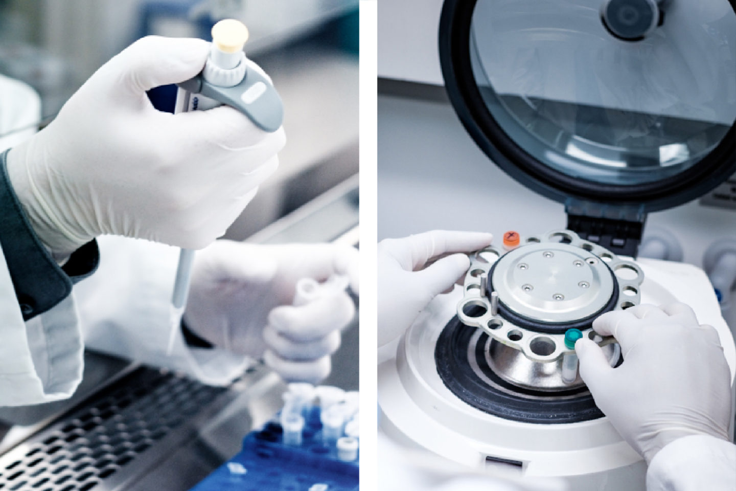 E. coli bacteria: There are good and bad ones | BIOMES